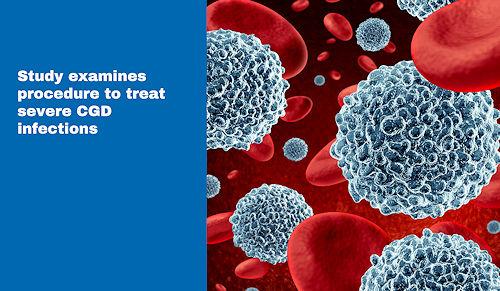 Study examines procedure to treat severe CGD infections | Immune ...